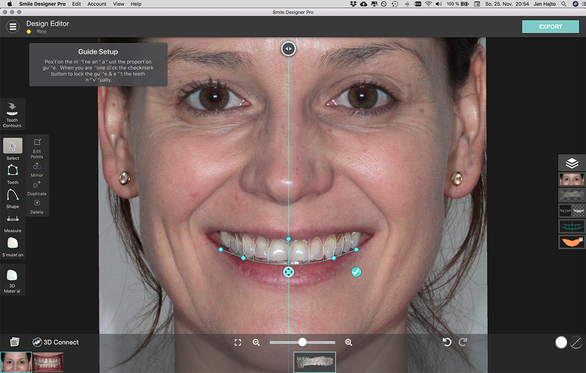Smile Design Pro - ایران کدکم - دندانپزشکی تمام دیجیتال تو