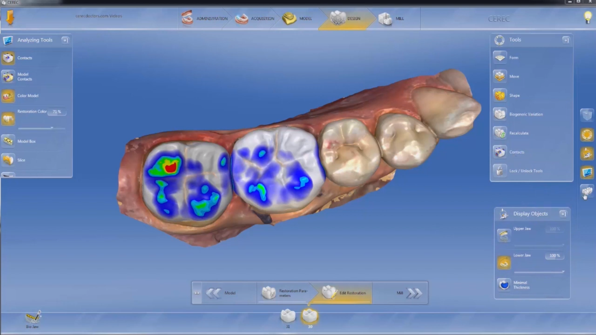 Cerec 5.2 - ایران کدکم - دندانپزشکی تمام دیجیتال تو